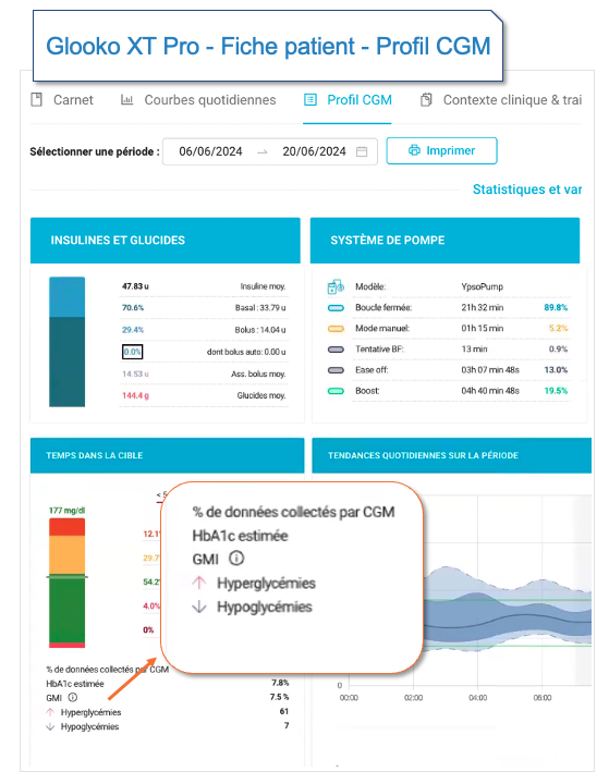 Je ne trouve plus la Vue Générale dans le profil patient – GlookoXT